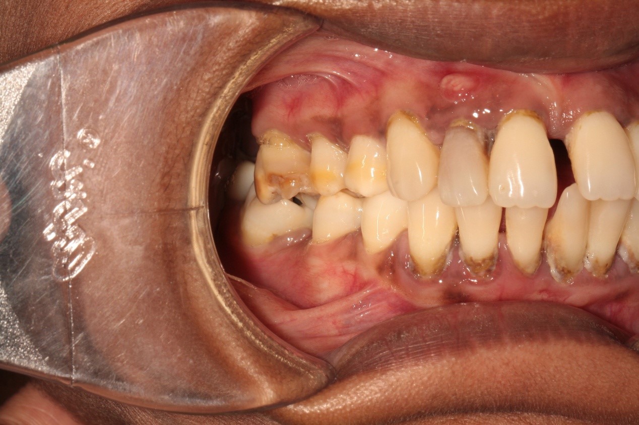 7 possible factors behind tooth pain - Sendhil Dental