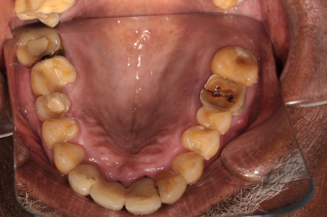 7 possible factors behind tooth pain - Sendhil Dental