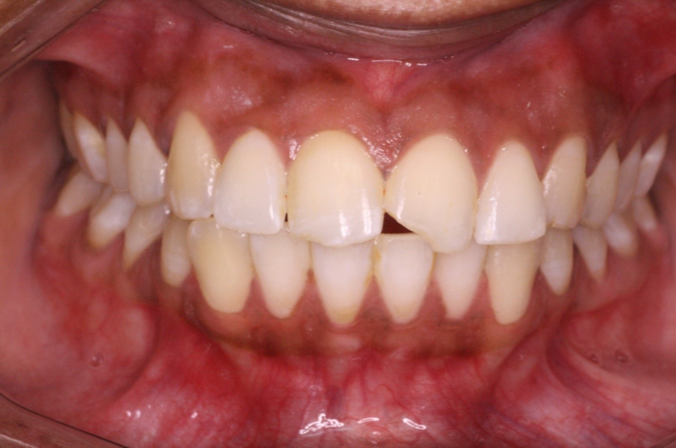 7 possible factors behind tooth pain - Sendhil Dental