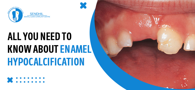 All you need to know about enamel hypocalcification - Senthil Dental Clinic