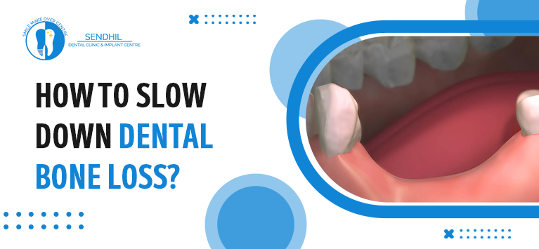 How to slow down dental bone loss? - Senthil Dental Clinic