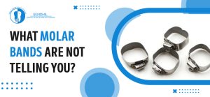 Molar Bands | Orthodontic Bands | Molar Bands Braces