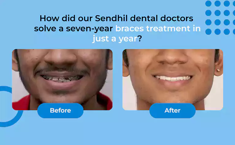 The story of bringing back a stunning smile nearly after a decade
