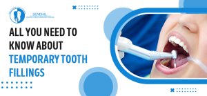 All You Need to Know About Temporary Tooth Fillings