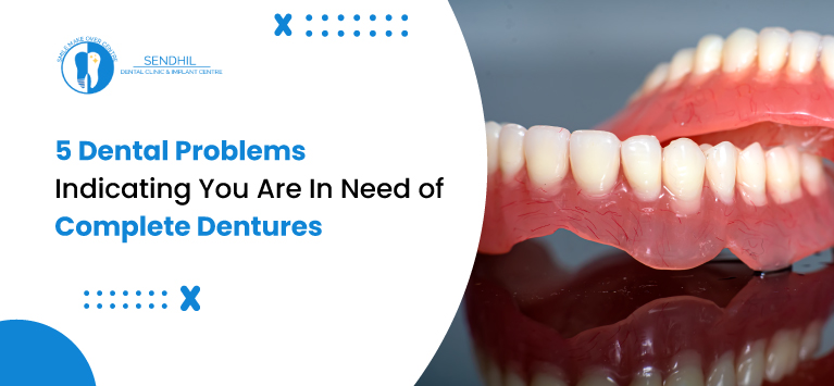 5 Dental Problems Indicating You Are In Need of Complete Dentures ...