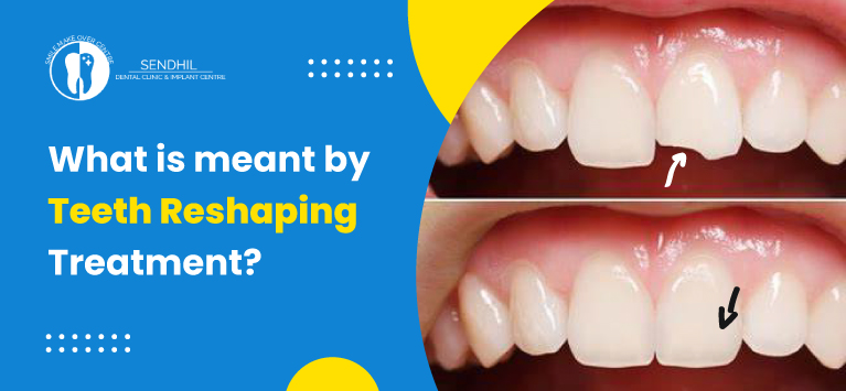 Tooth Reshaping | Tooth Contouring