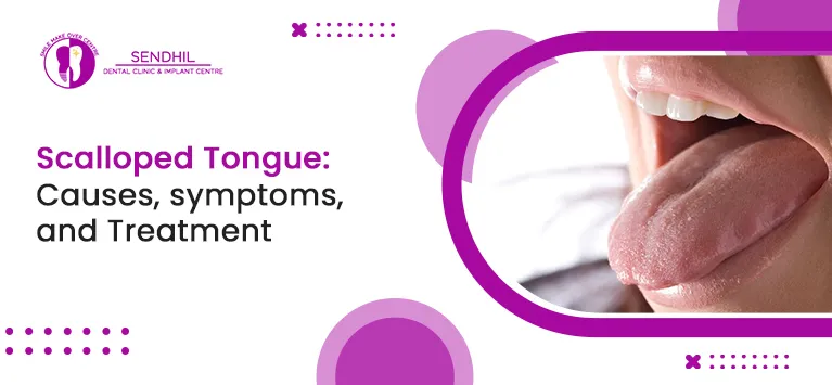 Scalloped Tongue: Causes, Symptoms, and Treatment